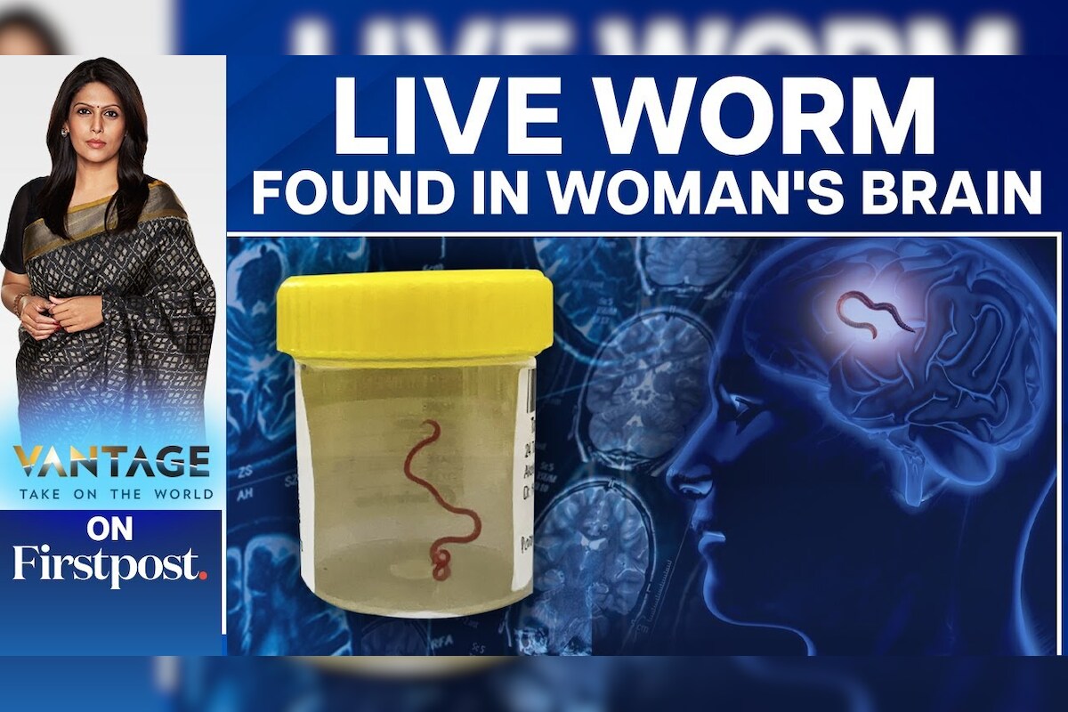 Live Worm Found in Australian Woman's Brain in World First | Vantage ...