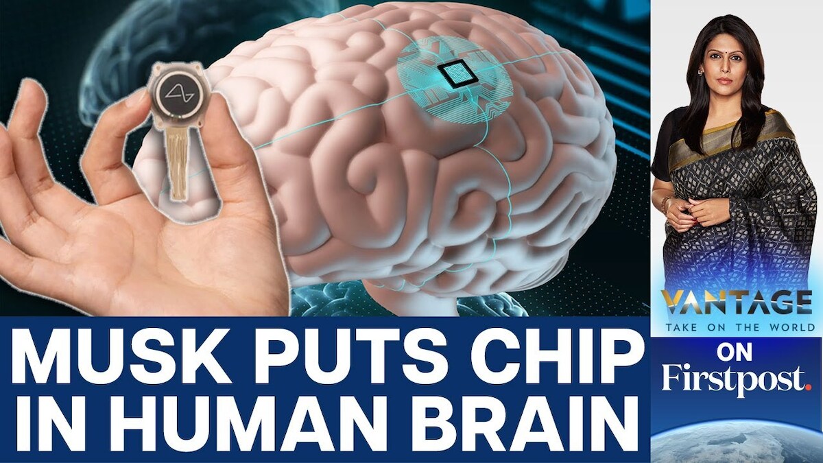 Elon Musks Neuralink Puts First Brain Chip In A Human Vantage With