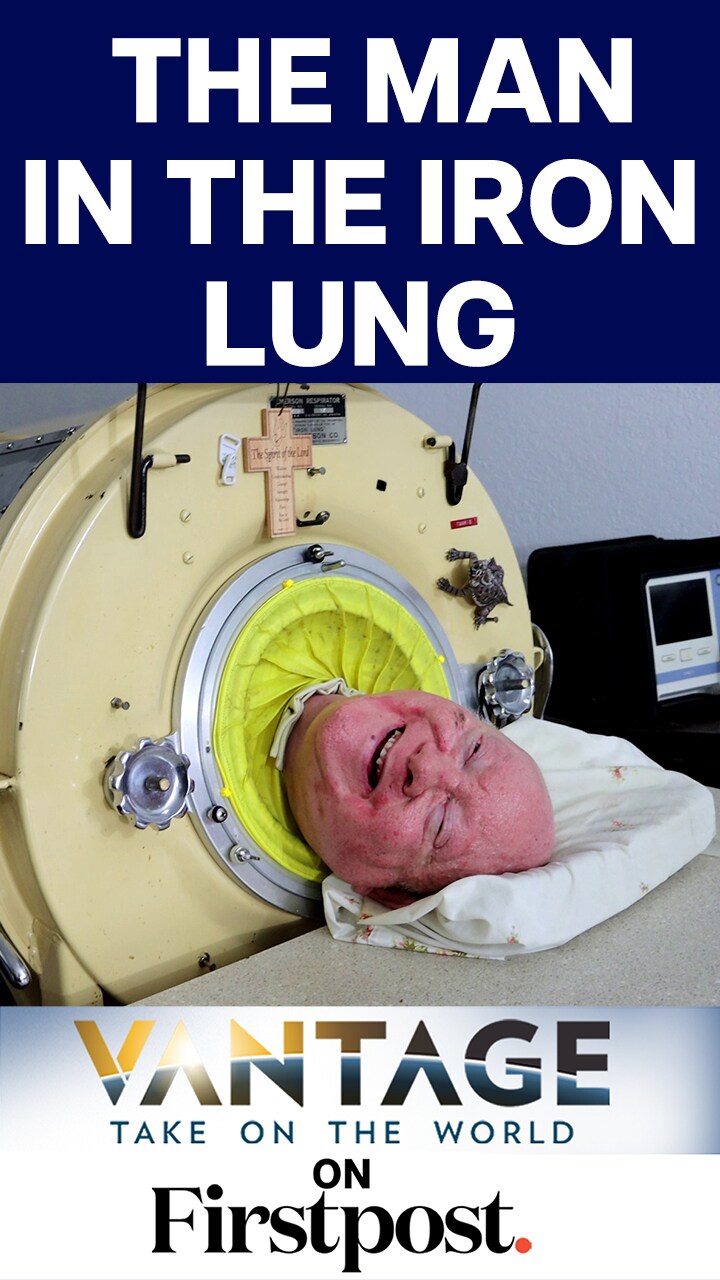 "Man in the Iron Lung" Dies at 78 After Defying Expectations