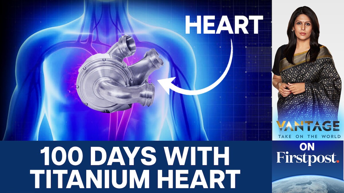 World's First: Man Lives 100 Days with Artificial Titanium Heart ...