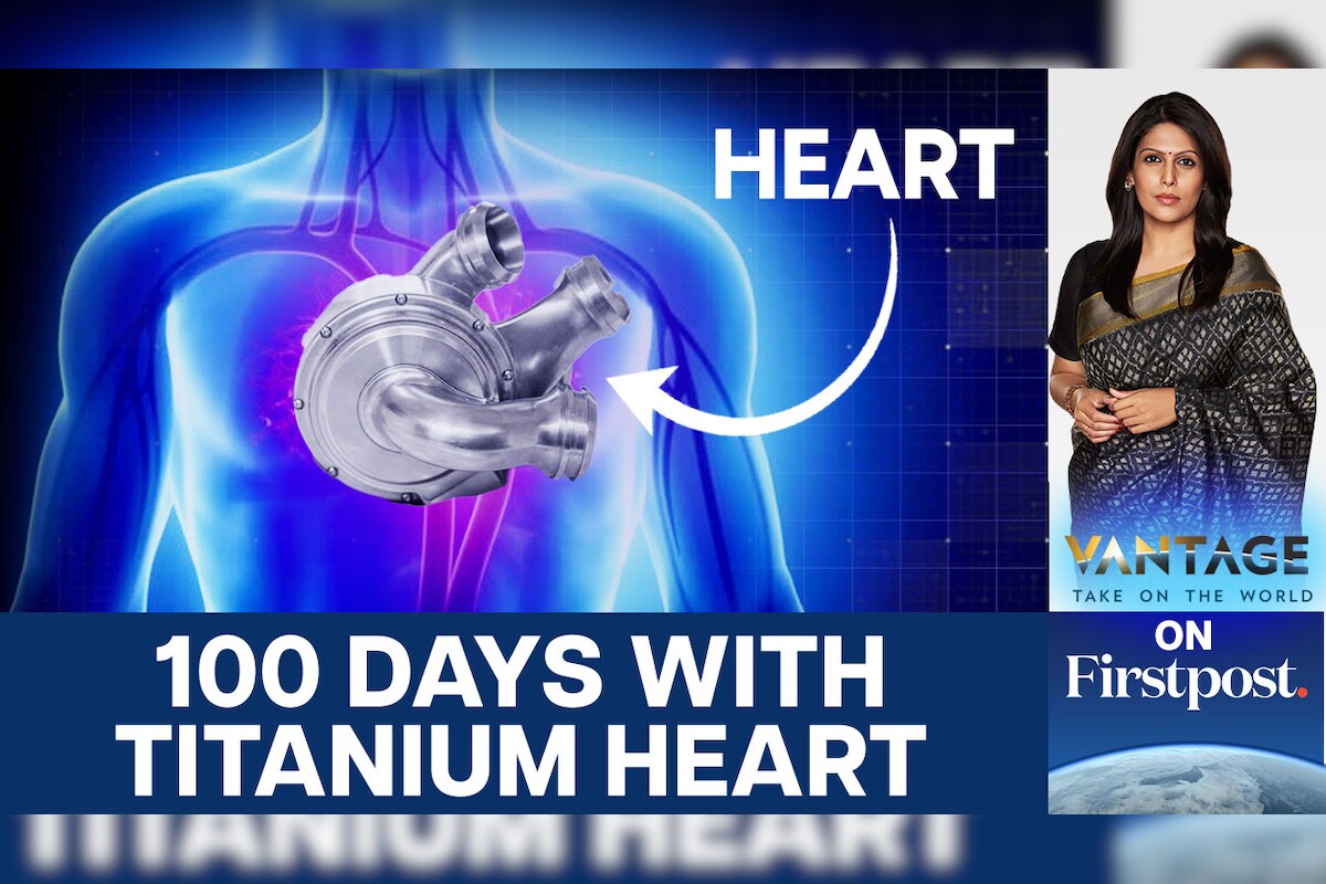 World's First: Man Lives 100 Days with Artificial Titanium Heart ...