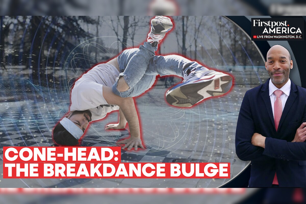 Dancer Develops a "Cone-Shaped" Head from Breakdancing Too Much