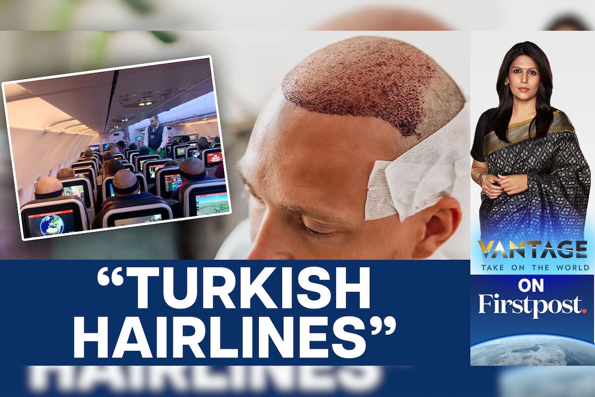 Is Turkey the World’s Hair Transplant Capital? | Vantage with Palki Sharma